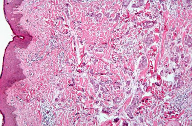 IPLab:Lab 7:IDC - Pathology Education Instructional Resource