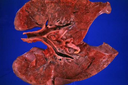 IPLab:Lab 12:Burns - Pathology Education Instructional Resource