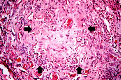 IPLab:Lab 12:Radiation Changes - Pathology Education Instructional Resource
