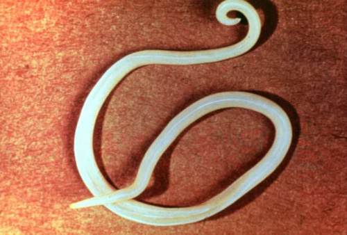 IPLab:Lab 11:Ascariasis - Pathology Education Instructional Resource