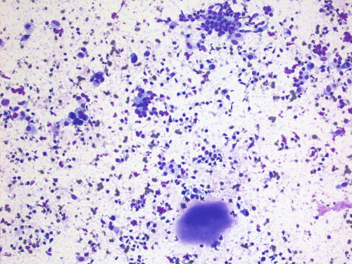 Cytologically Yours: CoW: 20131125 - Pathology Education Instructional ...