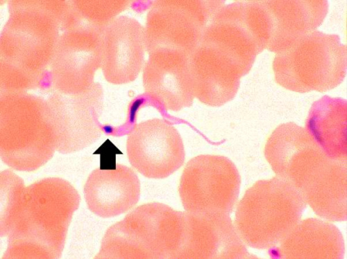 IPLab:Lab 11:Chagas Disease - Pathology Education Instructional Resource