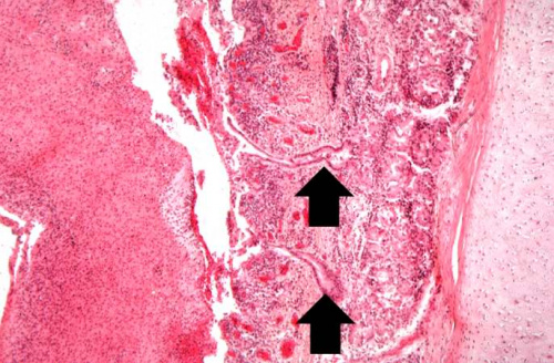 IPLab:Lab 9:Diphtheria - Pathology Education Instructional Resource