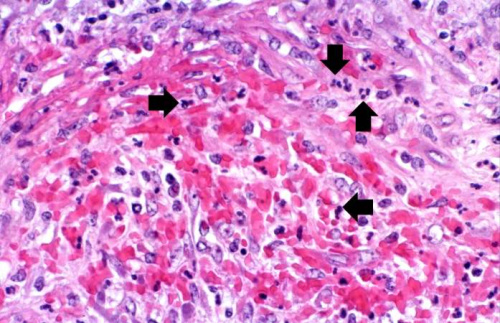 IPLab:Lab 6:PAN - Pathology Education Instructional Resource