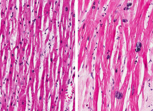 IPLab:Lab 2:Hypertrophy - Pathology Education Instructional Resource