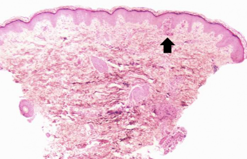 IPLab:Lab 9:RMSF - Pathology Education Instructional Resource
