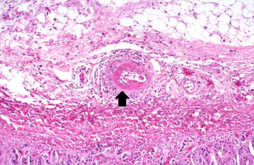 IPLab:Lab 6:PAN - Pathology Education Instructional Resource