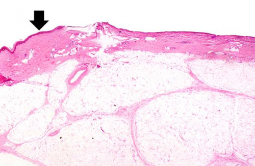IPLab:Lab 12:Burns - Pathology Education Instructional Resource