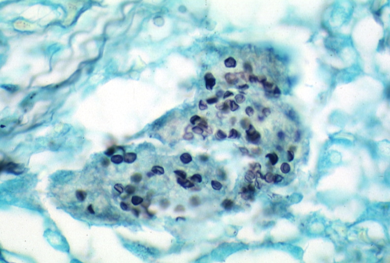 00017519 | PEIR Digital Library