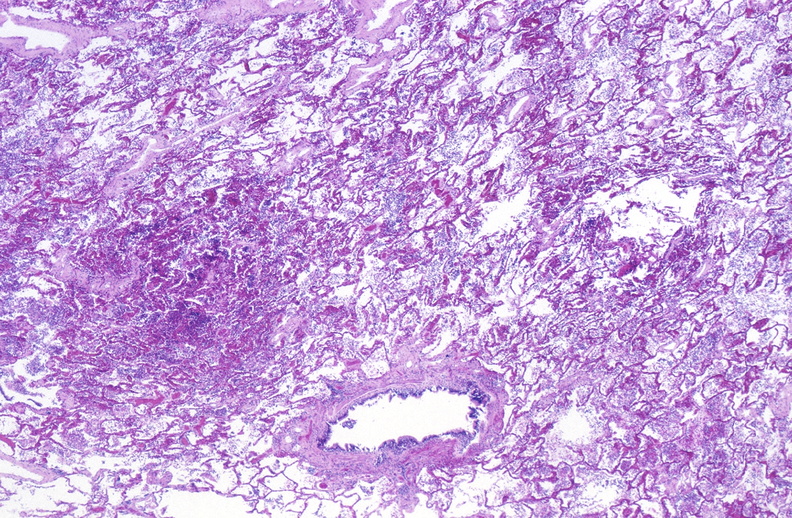 00015386 | PEIR Digital Library