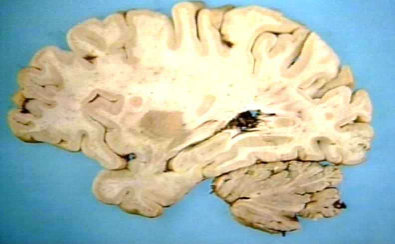 00204268 | PEIR Digital Library