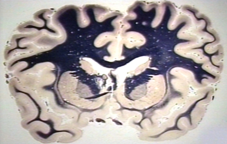 00205364 | PEIR Digital Library