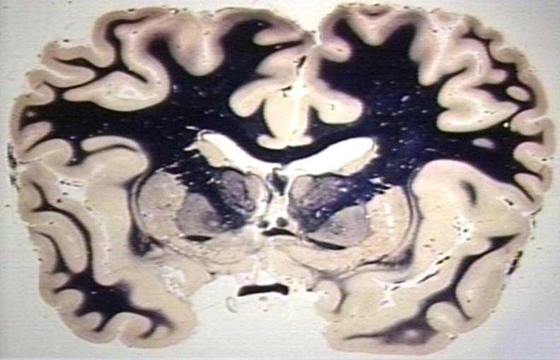 00205368 | PEIR Digital Library