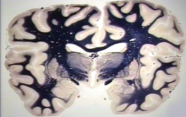 00205378 | PEIR Digital Library