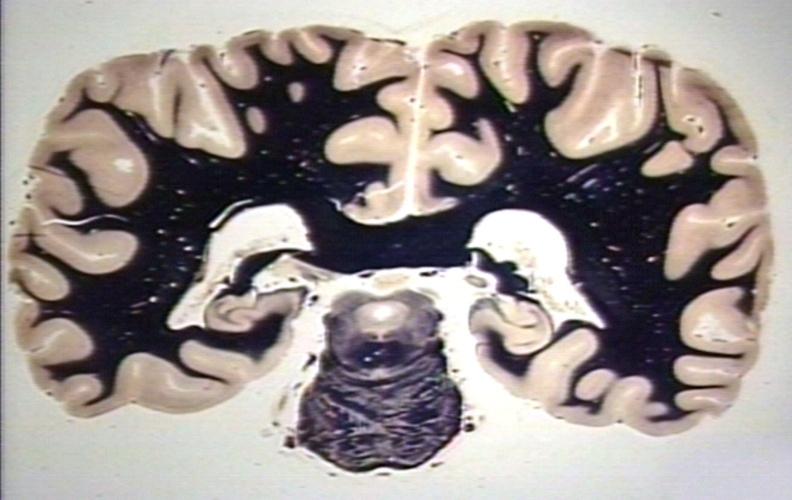 00205405 | PEIR Digital Library