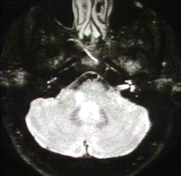 00216407 | PEIR Digital Library