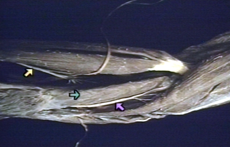 00218520 | PEIR Digital Library