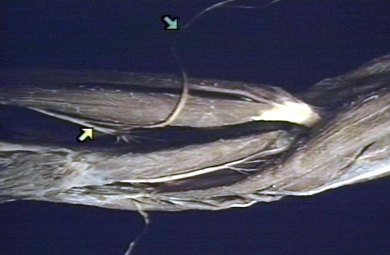 00218521 | PEIR Digital Library