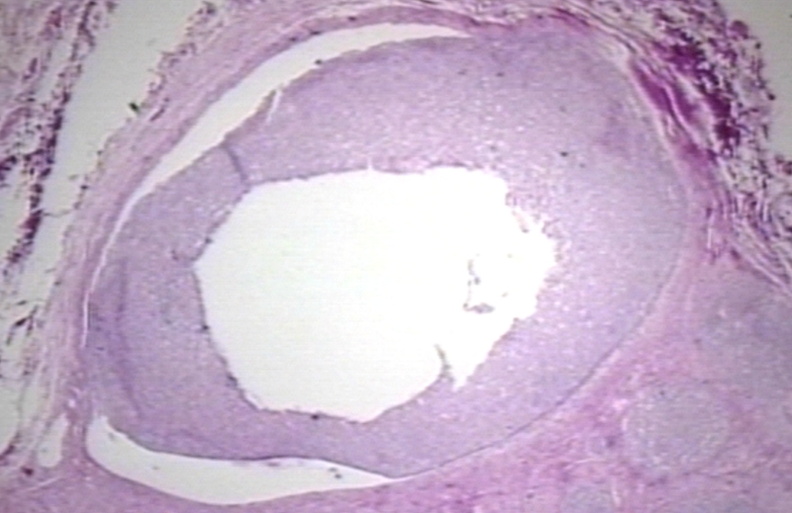 00221853 | PEIR Digital Library