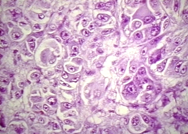 00222172 | PEIR Digital Library