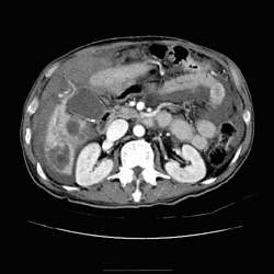 00133281 | PEIR Digital Library