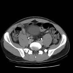 00134815 | PEIR Digital Library